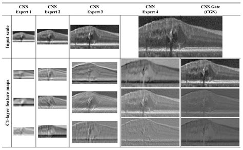 Extracted Feature Maps Of C1 Layers In The Trained L 3 − L 2 − L 1 − L Download Scientific