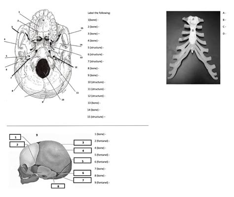 Solved In Lab Study Guide Axial Skeleton Lab Below Chegg Com