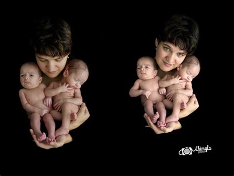 grossesse gémellaire Jumeaux Co le site des parents de jumeaux grossesse gémellaire