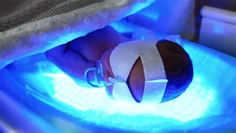 「Bilirubin」の写真素材 | 2,361件の無料イラスト画像 | Adobe Stock