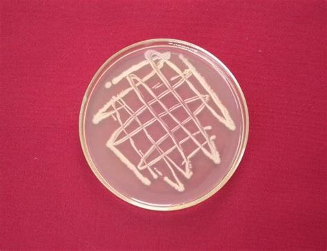 A To C Biological Control Agents A Bacillus Subtilis B Pseudomonas Download Scientific