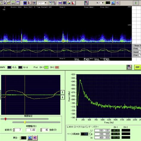 Sound Spectrogram Display Of Lung Sounds In A Patient Upper Figure