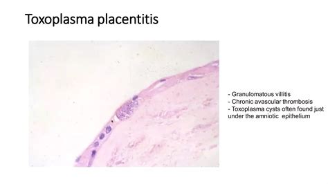 Placenta Pathology Pdf Pregnancy Reproductive Health