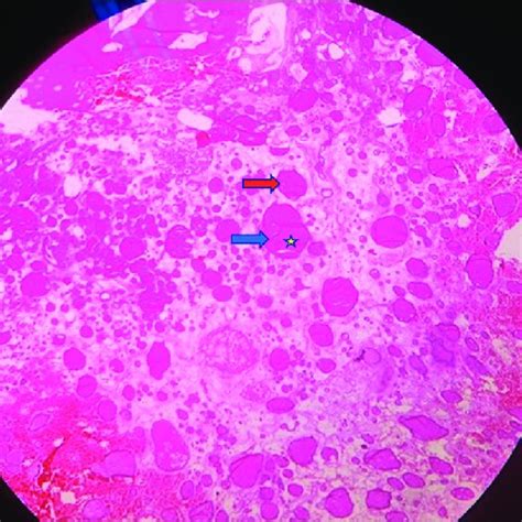 H And E ×40 Showing Numerous Thyroid Follicles Of Varying Size With Download Scientific