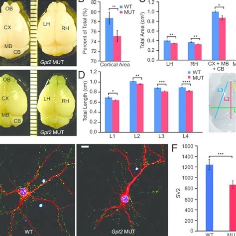 Gpt Deficiency Causes A Reduction In Brain Size In Mouse A Panels Download Scientific