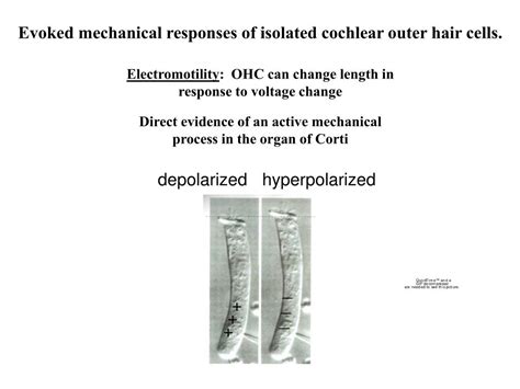 Ppt The Peripheral Auditory System Powerpoint Presentation Free