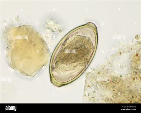 Parasitic Worm Egg Light Micrograph Of The Egg Of A Parasitic Whipworm