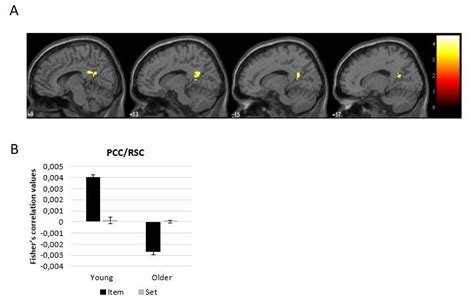 A Encoding Retrieval Similarity Age Group Young Vs Older X Level