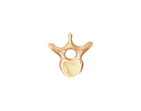 Vertebral Axial Quiz