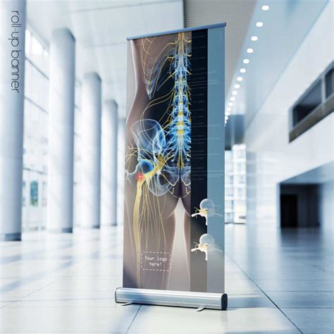 Sciatica And Stenosis Educare Design