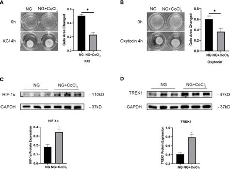 High Glucose Induced Hif 1α Trek1 Expression And Myometrium Relaxation During Pregnancy Pmc