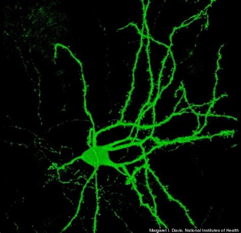 Brain Activity Map Proponents Explain Goals Of Bold Neuroscience Project Huffpost Impact