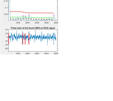 Fetal Ecg Signal And Fetal Heart Rate Extraction Techieyan