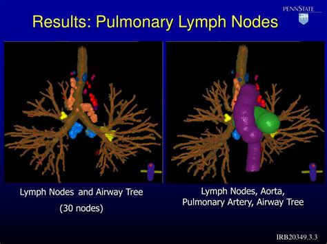 Ppt Extraction And Visualization Of The Central Chest Lymph Node Stations Powerpoint