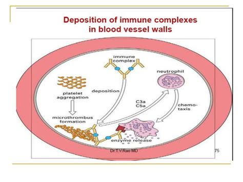 Hypersensitivity And Its Causes And Effectsppt