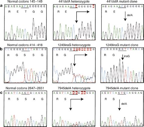 Frameshift Mutations Of Patients With Iv A Direct Dna Sequencing Of Download Scientific