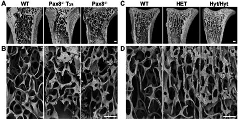 Topographic Three Dimensional Bse Sem Analysis Of Bone Structure In