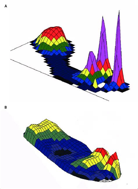 Plantar Pressure Distribution Under The Foot During A Barefoot Download Scientific Diagram