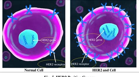 Figure 5 From A New Approach For Breast Cancer Detection Based Machine