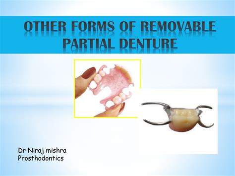Classification Of Removable Partial Denture Ppt Design Talk