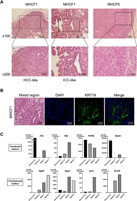 Histological Findings And Hepatocyte And Cholangiocyte Markers Of The