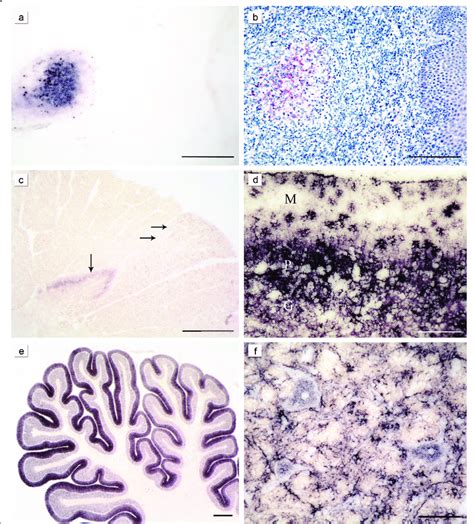 Characteristic Prp Sc Deposition Patterns In Classical And