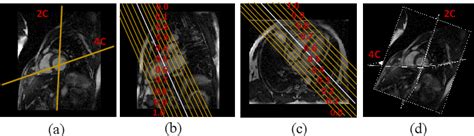 Self Supervised Learning For Medical Image Data With Anatomy Oriented