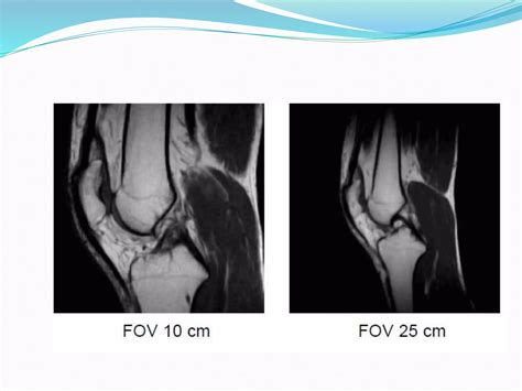 Mri Parameters For Imaging Pptx