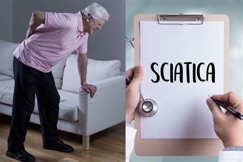 Is Sciatica A Disability Sciatica Pain Guide