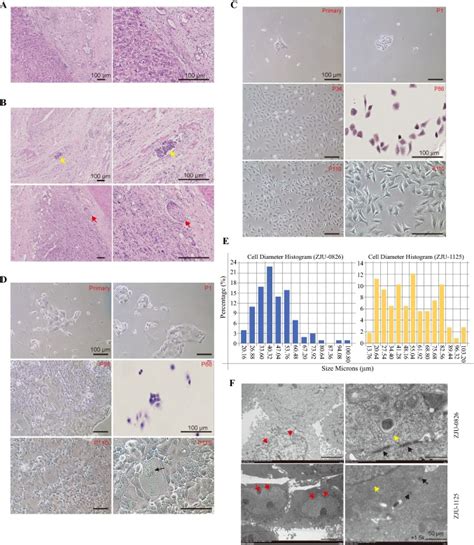 Establishment And Characterization Of Two Novel Cholangiocarcinoma Cell