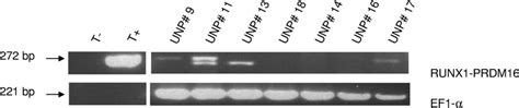 Ethidium Bromide Stained Gel Showing Expression Of Runx1 Prdm16 Fusion