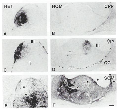 Figure 1 From Transplantation Of The Rat Suprachiasmatic Nucleus