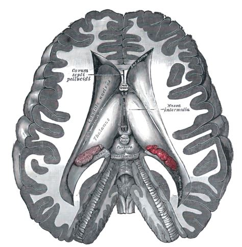 Dissection Showing Ventricles Of Brain Human Anatomy Classroom Clip Art