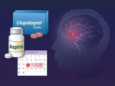 Dapt Up To 72 Hours After Ischemic Stroke New England Journal Of Medicine