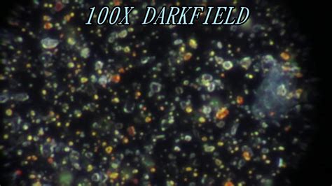 Dark Field Microscopy Bacteria