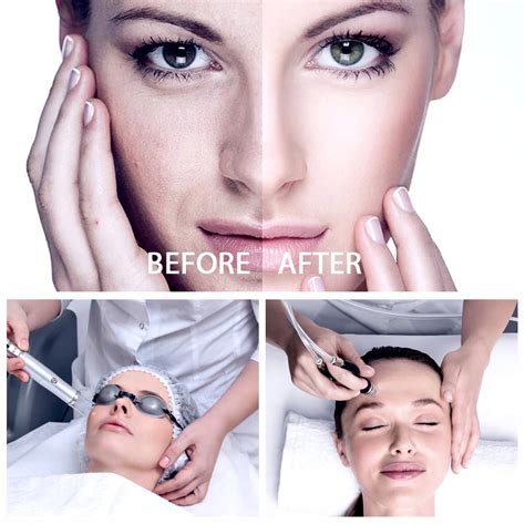 Premier Zero Pimple Premier Clinic