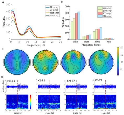 Figure 2 From Gating Attractor Dynamics Of Frontal Cortex Under Acupuncture Via Recurrent Neural