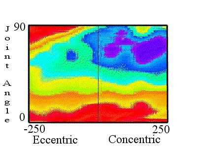 Isomap Isokinetics Net