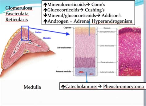 Adrenal Hyperfunction Cushing Conns Pheochromocytoma Flashcards Quizlet