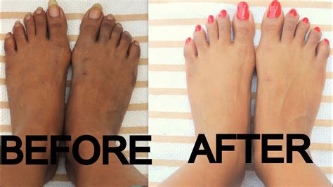 Diy Pedicure At Home Dark Brown Tan Feet Minniedas Youtube