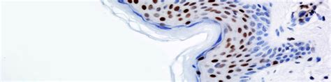 Leveraging Clinical Trial Ready Ihc Assays From Target Validation To Leveraging Clinical Trial Ready Ihc Assays From Target Validation To