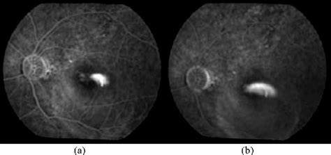 Figure 10 From A Partial Intensity Invariant Feature Descriptor For Multimodal Retinal Image