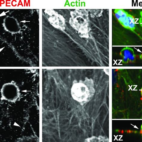 Targeted Traffi Cking Of Membrane From The Lbrc To Surround Leukocytes