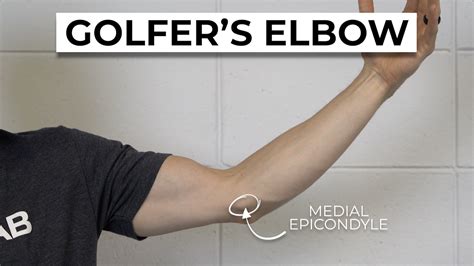 Golfers Elbow E3 Rehab