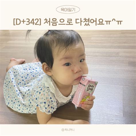 어린이집 사고 아기 얼굴 상처 네이버 블로그