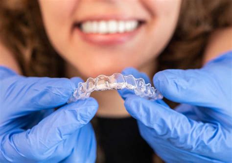 Top Invisalign Braces In West London Uk Cost And Expertise