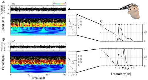 Electroencephalographic Characterization By Covariance Analysis In Men