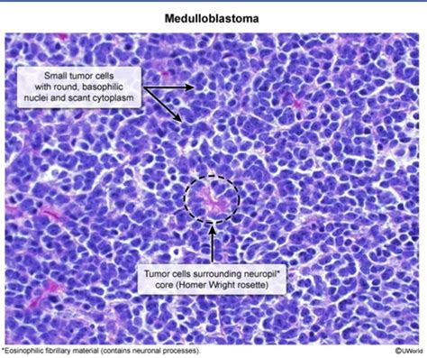 Neuro Flashcards Quizlet