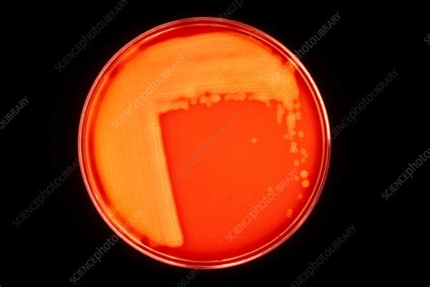 Streptococcus Pyogenes Stock Image C004 6905 Science Photo Library