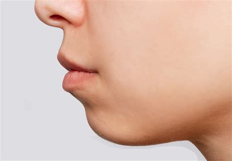 Small Retracted Chin Alisha Louise Aesthetics Skelmersdale